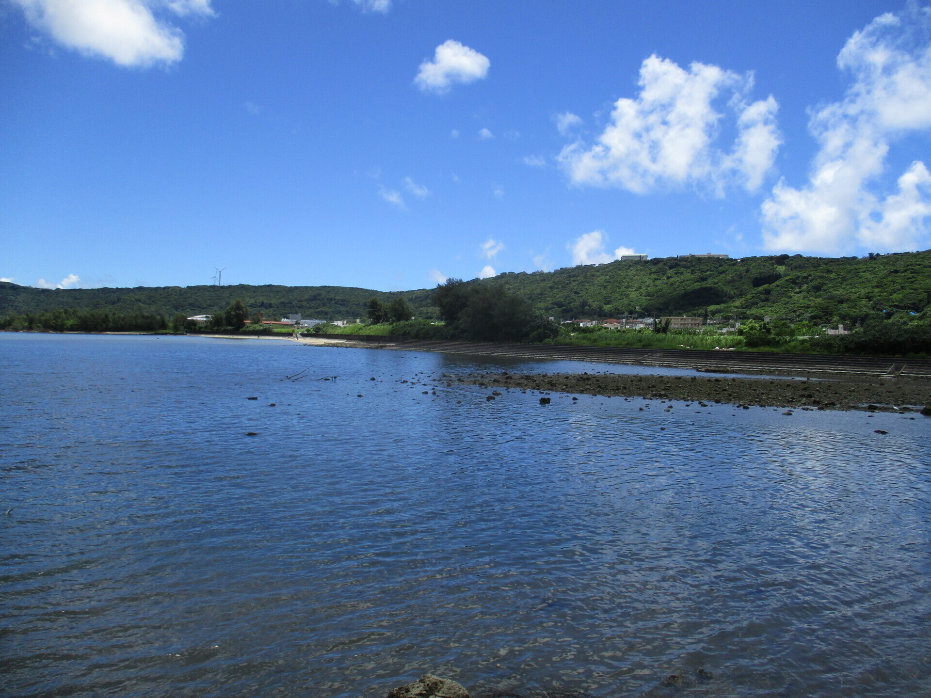 網膜塞栓症の原因: 燃えるフィジカルアセスメント