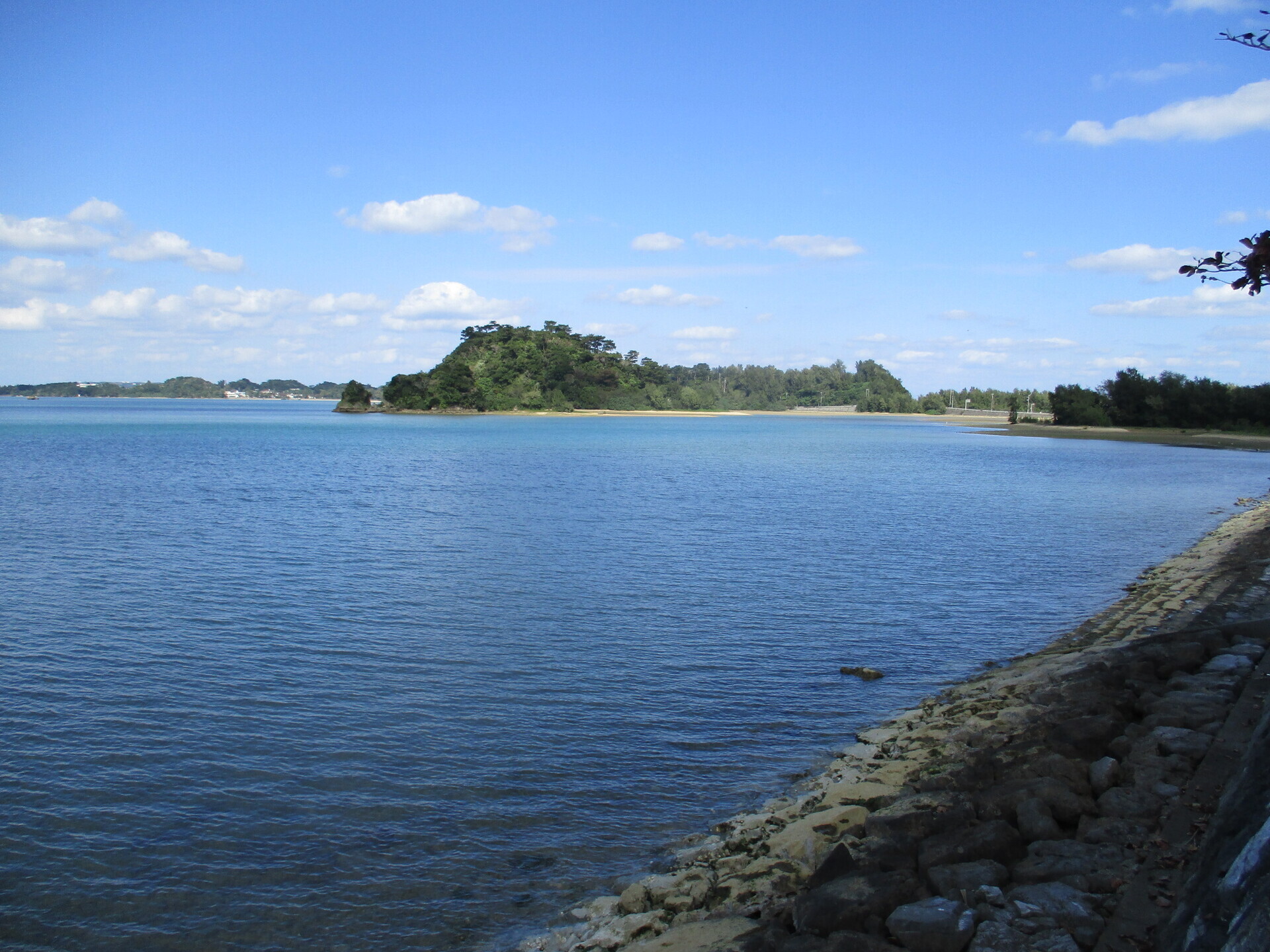 耳垂のしわ (Earlobe Creases, Frank徴候): 燃えるフィジカルアセスメント